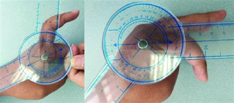 Clinical Evaluation The Mcp Joint S Range Of Motion In Extension Left