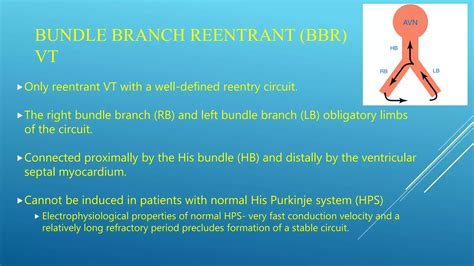 Management Of Ventricular Tachycardia Vt Pptx