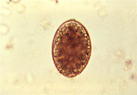 Diphyllobothrium Latum