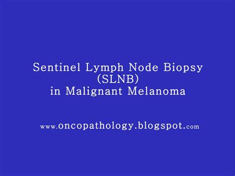Melanoma Sentinel Lymph Node Ppt
