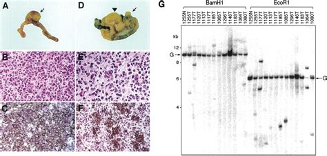Liver Is Enlarged And Diffusely Echogenic Diffusely Heterogeneous Echotexture Treatment For