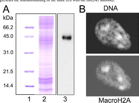 Figure 1 From Weak But Uniform Enrichment Of The Histone Variant Macroh2a1 Along The Inactive X