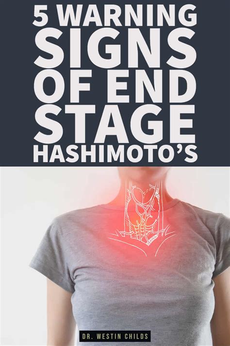 5 Signs Of End State Hashimotos And What It Means