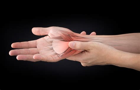 Signs You May Have A Torn Ligament In Your Wrist
