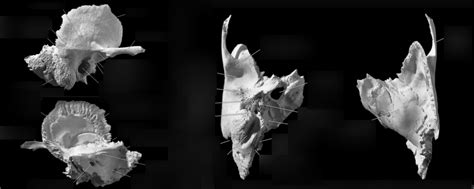 Temporal Diagram Quizlet