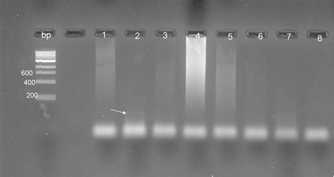 Pcr Amplification Utilizing Fecal Samples Using The Its 1pcr Reaction