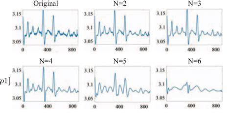 Figure 1 From A Feature Extraction Method Of Pipeline Magnetic Flux Leakage Signal Based On