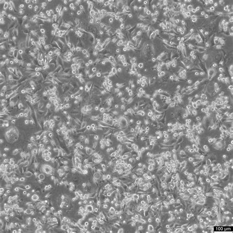 Exemples De Lignées Cellulaires Humaines 9 Lignées De Cellules