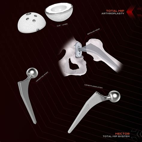 Arthroplasty Total Hip System Normmed Medical