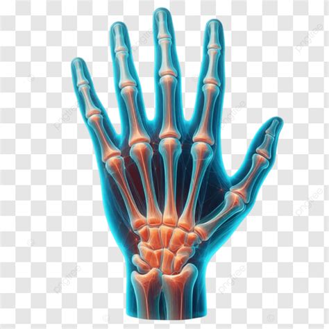 Anatomía Humana Mano Anatomia Y Huesos De La Mano Fracturas Mas