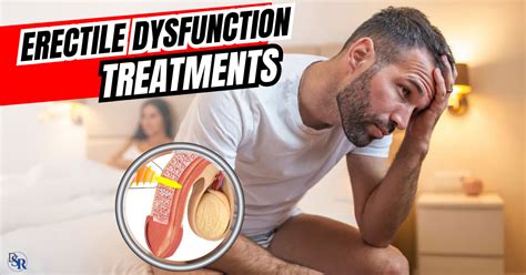 👍 8 Best Erectile Dysfunction Ed Treatments In 2026