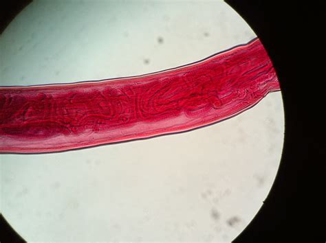 Ancylostoma Caninum Female 4 Dralashiekh Flickr