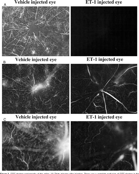 Figure 3 From A Model Of Retinal Ischemia Reperfusion Injury In Rats By