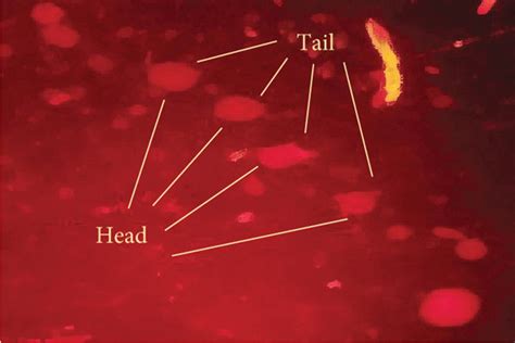 Microscopic View Of A Comet Cells Along With Head And Tail And B