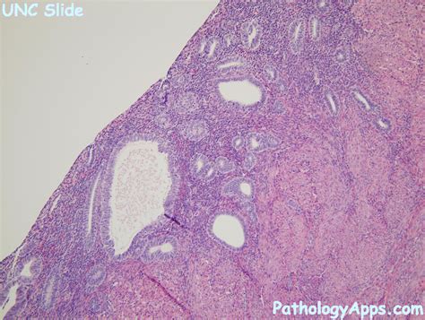 Proliferative Endometrium Histology