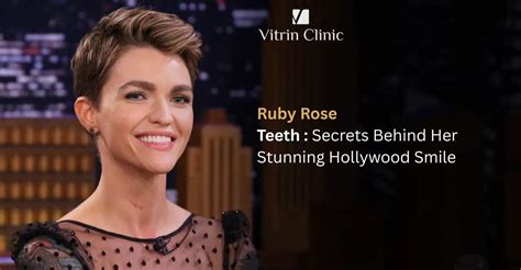 Ruby Rose Teeth Smile Aesthetic Guide Vitrin Clinic