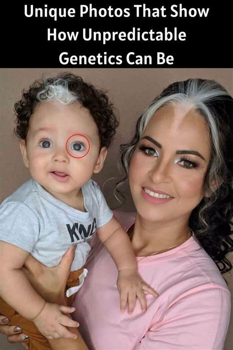 Unique Photos That Show How Unpredictable Genetics Can Be Genetics
