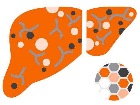 Addressing The Rising Prevalence Of Nafld Siemens Healthineers