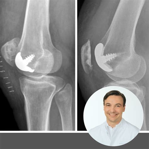 Stefanie Schausten Posted On Linkedin