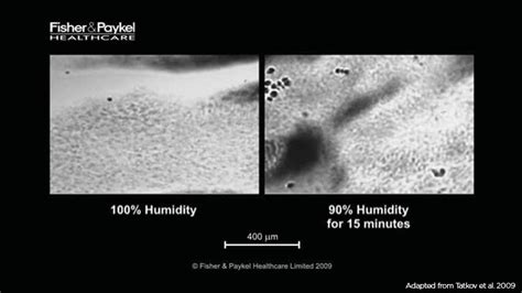 Mucociliary Transport System Fisher And Paykel Healthcare