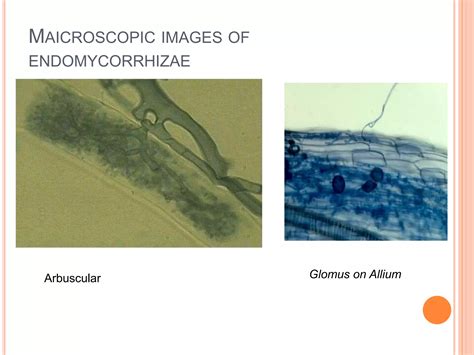 Ecto And Endomycorrhizae And Their Significance Pptx