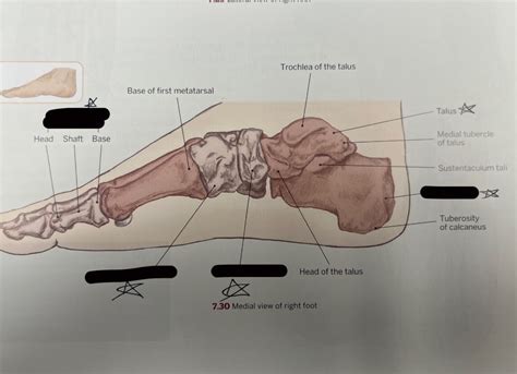 Final 3 Diagram Quizlet