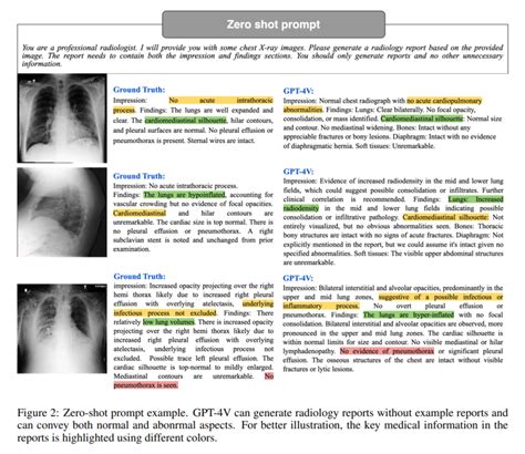 Gpt 4v Can Generate Radiology Reports Without Example Reports And Can Download Scientific