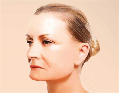 Fixed Implants Vs Dentures Fixed Teeth Australia