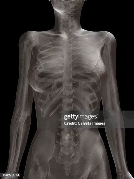 Ilustraciones Imágenes Clip Art Dibujos Animados E Iconos De Stock De Human Skeleton Black