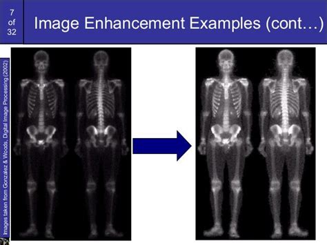 Image Processing3 Imageenhancementhistogramprocessing