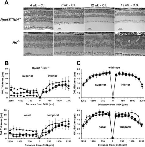 Retinal Histology And Thickness Measurements In Rpe65 Nrl Download Scientific Diagram