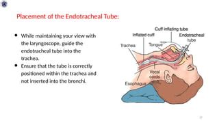 Anesthesia And Reanimation Airway And Entubationpptx