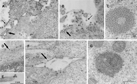 Effect Of Derivative 104 On Viral Morphogenesis Confluent Vero Cells