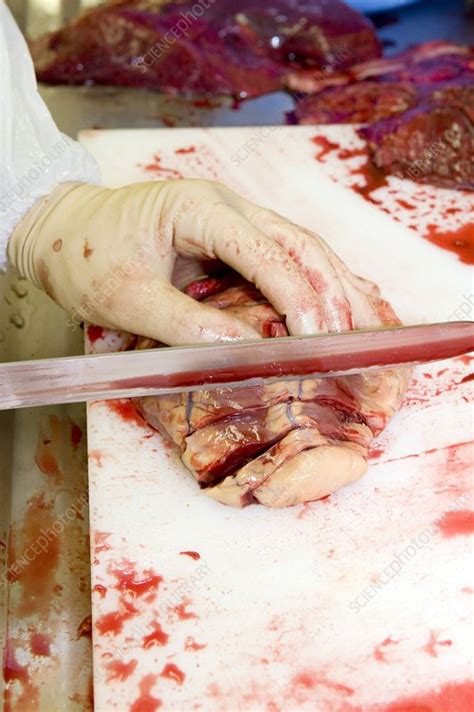 Heart Post Mortem Stock Image M8760150 Science Photo Library