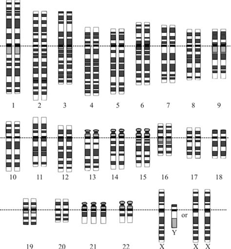 Difference Between Aneuploidy And Polyploidy Definition