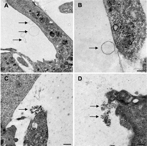 Depiction Of The Two Examined Ev Classes Transmission Electron