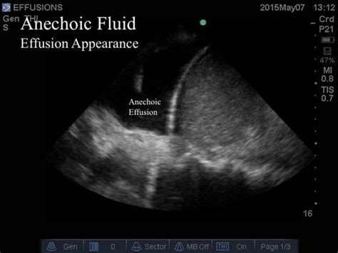 Internal Medicine Point Of Care Ultrasound Impocus