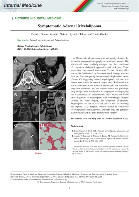 Pdf Symptomatic Adrenal Myelolipoma