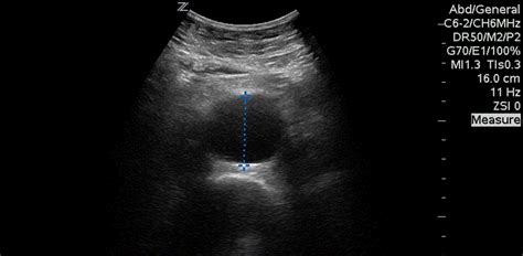 Cemo Virtual Cemo Ottawa