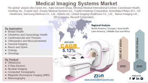 Global Medical Imaging Systems Market Revenue Estimated Around Usd 71