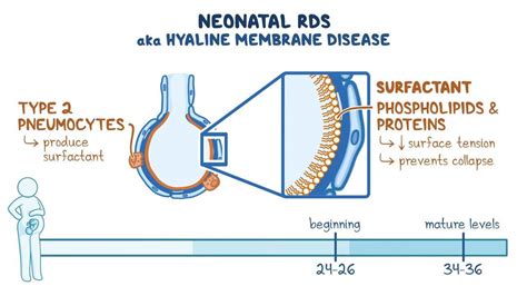 Neonatal Respiratory Distress Syndrome Video And Meaning Osmosis