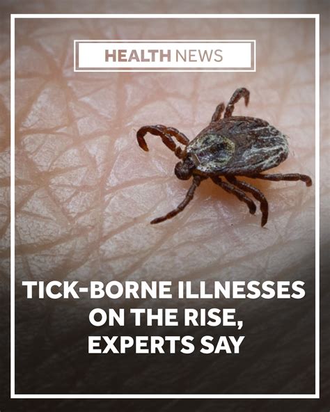 Wlwt Why Are Tick Borne Illnesses On The Rise In The Facebook