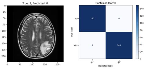 Brain Tumor Mri Classification Reporter Moshu Huang By Moshu Medium