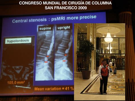 Dr Juan Francisco Lasso Dr Juan Francisco Lasso