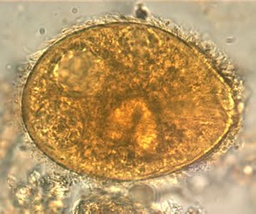 Balantidium Coli