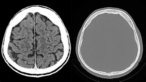 Photo Gallery Of Brain Imaging