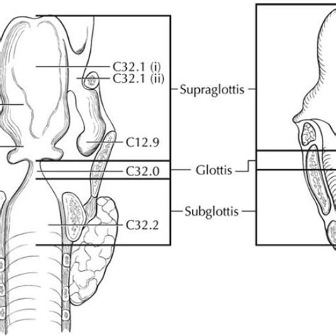 Gambar 2 Gambar Massa Di Plika Vokalis Yang Meluas Ke Supraglotis T2