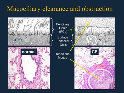 Ppt Bonnie Ramsey Md Powerpoint Presentation Free Download Id