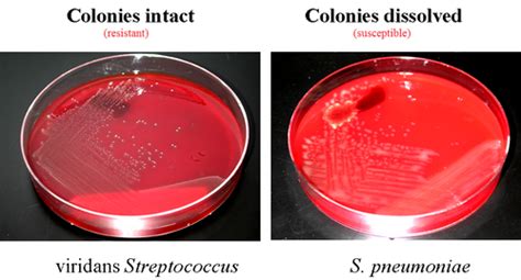 Bile Solubility Test