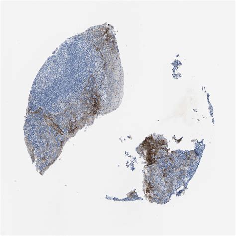 Tissue Expression Of Cldn3 Staining In Tonsil The Human Protein Atlas